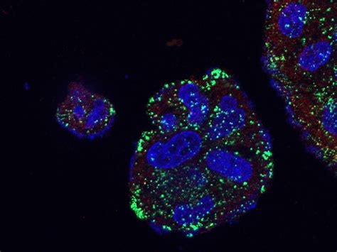Cd63 Antibody 25682 1 Ap Proteintech
