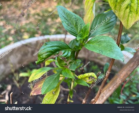 Distinguishing Between Different Fungal Bacterial Infections Stock Photo Shutterstock