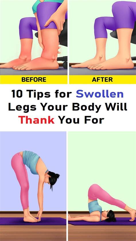 10 Tips For Swollen Legs Your Body Will Thank You For Swollen Legs