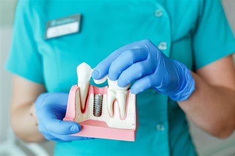 Recovery After Dental Implants Life Management Center