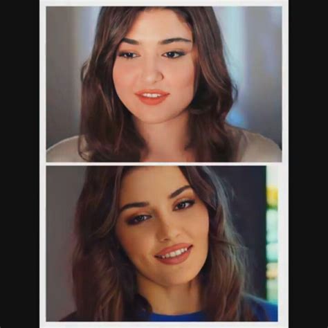 Before And After Plastic Surgery In 2022 Plastic Surgery Hande Ercel