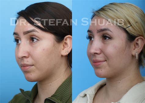 38 Dallas Facial Plastic Surgery Center