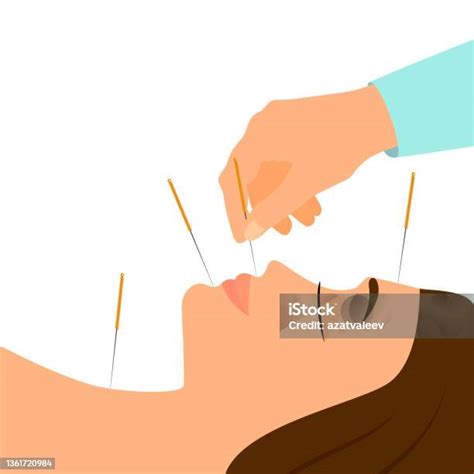 여성의 얼굴과 중국 바늘침술 배너 대체 의료 및 의학 포스터 템플릿 의료 벡터 일러스트레이션 사람 얼굴에 대한 스톡 벡터 아트
