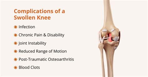 Swollen Knee Causes Symptoms Treatment And Prevention Seamless