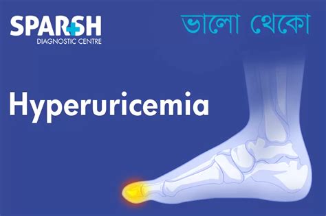 Hyperuricemia Sparsh Diagnostic Center