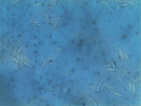 Microscopic Examination Of The Morphology M Gypseum Fusiform