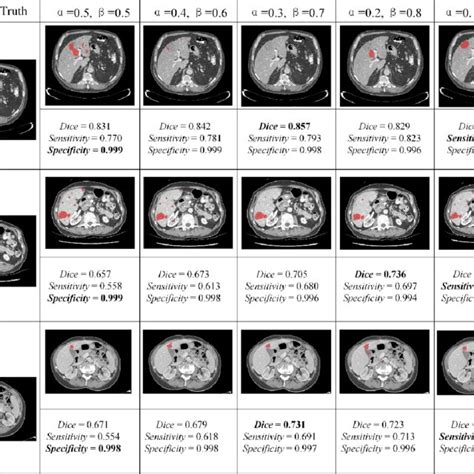 Comparative Results Of The Hybrid Loss Function Using Different