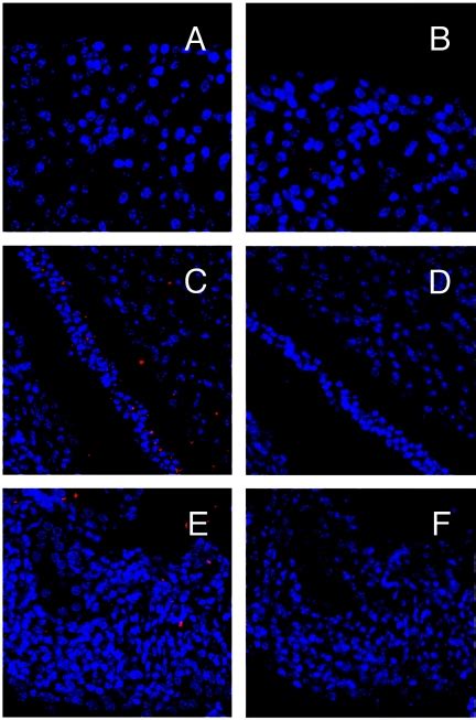 Enterococcus Faecalis Tropism For The Kidneys In The Urinary Tract Of