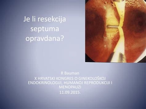 Septum Uterusa Je Li Resekcija Opravdana Septate Uterus Is