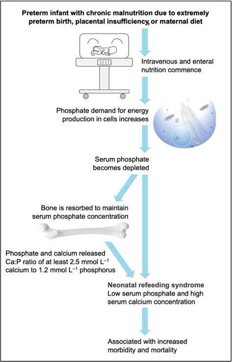 Association Between Early Phosphate Intake And Refeeding Syndrome In