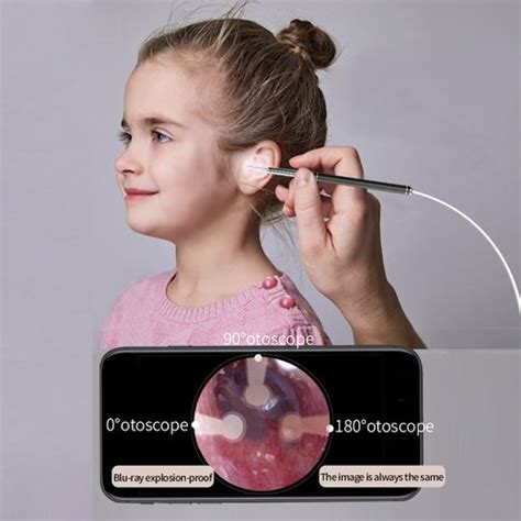 Generic Smart Ear Cleaner Endoscope Spoon Camera Ear Picker Cleaning