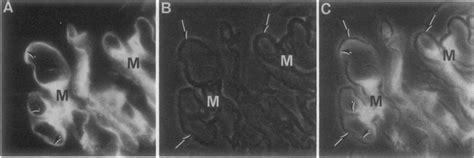 Photomicrograph Of A Segment Of A Glomerulus A Immunofluorescent