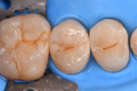 Chameleon Composite Functionality