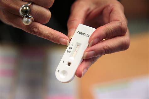 Covid 19 à Quoi Servent Encore Les Tests Sérologiques Journal La