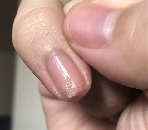 This Booger Looks Like Dick And Balls Rmildlyinteresting