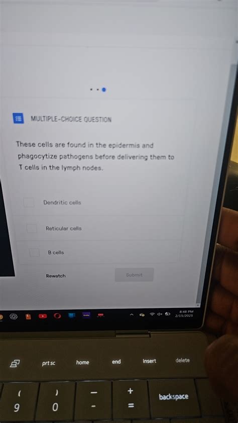 Multiple Choice Questionthese Cells Are Found In The Epidermis And Phag