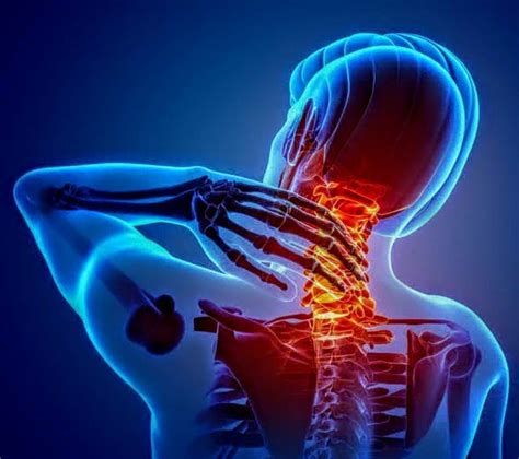 Manual Cervical Distraction Technique Archives Pt Master Guide
