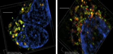 Munc13 4 Promotes Exosome Rele Image Eurekalert Science News Releases