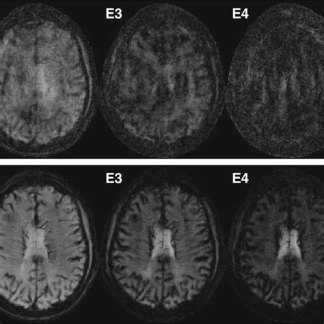 Abbreviations AIF Arterial Input Function GM Gray Matter WM White