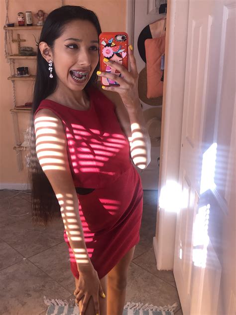 Can My Braces Just Stay On Forever ♾ Scrolller