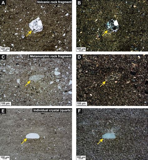 Photomicrographs Showing Examples Of Different Types Of Outsized