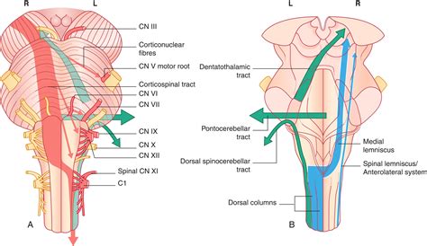 Brainstem Clinical Tree