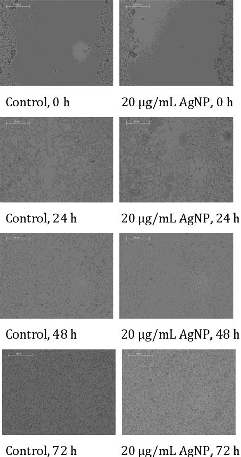 Figure 1 From Cytotoxicity And Wound Healing Capacity Of Biologically