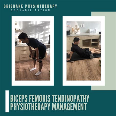 Biceps Femoris Tendinopathy Physiotherapy Management Brisbane