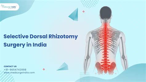 Selective Dorsal Rhizotomy Surgery Cost In India Medsurge India