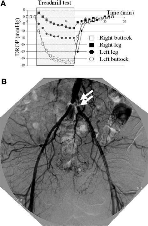 A Transcutaneous Oxygen Pressure Ptc O 2 Measurements At Exercise Download Scientific Diagram