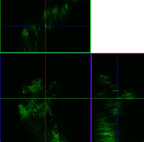 Clsm Image Of Biofilm Attached To Gac Particle In Flasks With
