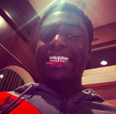 Kodak Black Surgically Removes His Gold Teeth Smile
