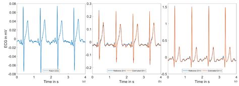 Wearable Cardiorespiratory Monitoring Employing A Multimodal Digital Patch Stethoscope