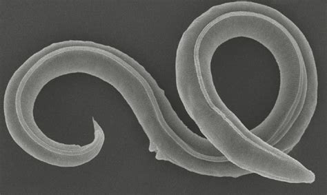 Roundworm Movement