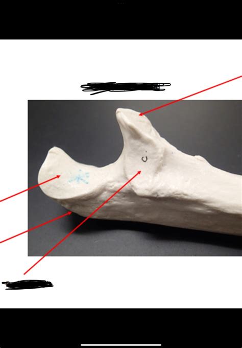 Lab Exam 2 Diagram Quizlet
