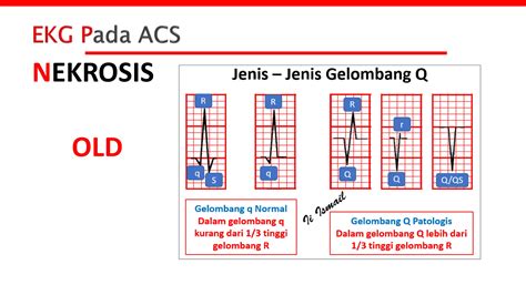 Acs Code Blue Autosaved Pptx