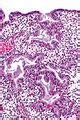 Secretory Phase Endometrium Libre Pathology