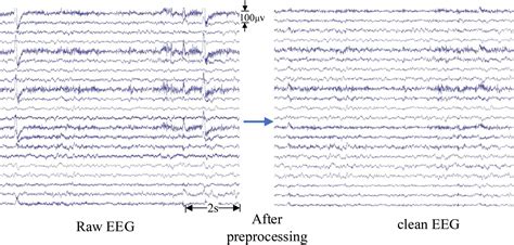 Frontiers Epileptic Prediction Using Spatiotemporal Information