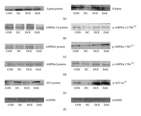 Effects Of Acute Exercise And Chronic Exercise On The Liver Leptin Ampk