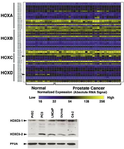 a heat map representation of log2 transformed rma normalized