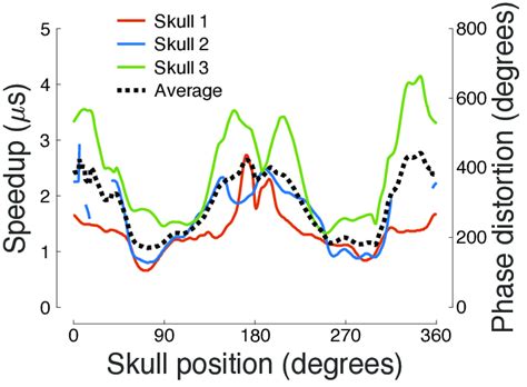 Speedup And Phase Distortion Across The Skull Ultrasound Speedup Download Scientific Diagram