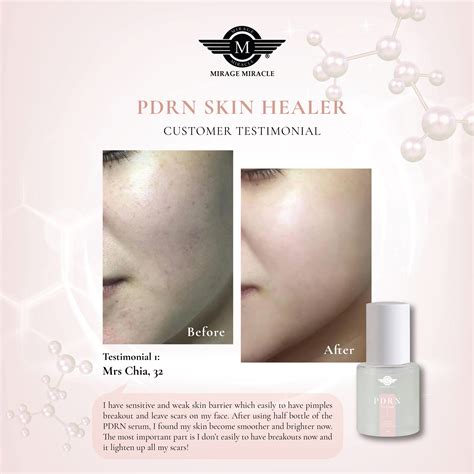 PDRN Skin Healer Serum - Mirage Aesthetic