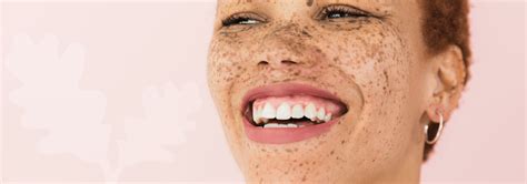 Gapped Teeth Concerns Invisalign Midhurst Woodcroft Dental