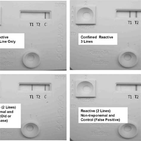 Dual Poc Syphilis Tests Showing Patterns Of Reactivity And Their