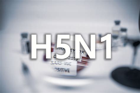 인플루엔자 A 바이러스 아형 H5n1 단어 질병 및 청진기의 클로즈업 의료 건강 개념 조류 인플루엔자 바이러스에 대한 스톡 사진