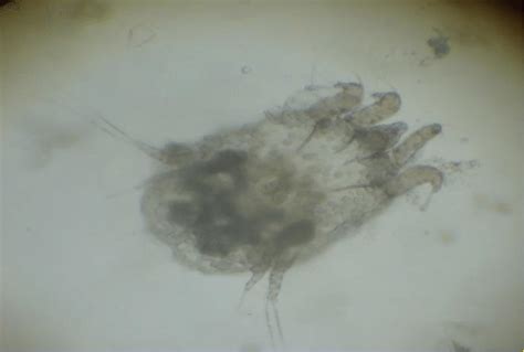 Ventral View Of Female Psoroptes Spp Mite From A Buffalo Host Under