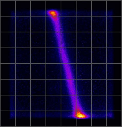A Collimated Line Image Generated Using A Cs 137 Gamma Source Sipm