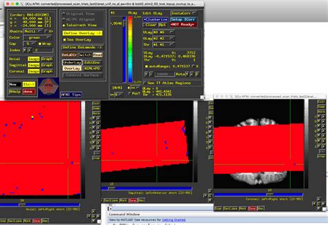 Overlay Values Are Outside The Range Of Possible Values AFNI Message