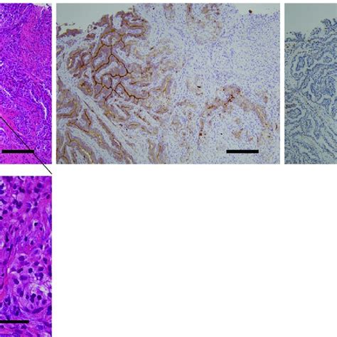 Pathological Biopsy Findings In He Staining Cells With Intranuclear Download Scientific