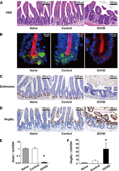Reciprocal Control Of Expression Of Paneth Cell Derived A Defensins And